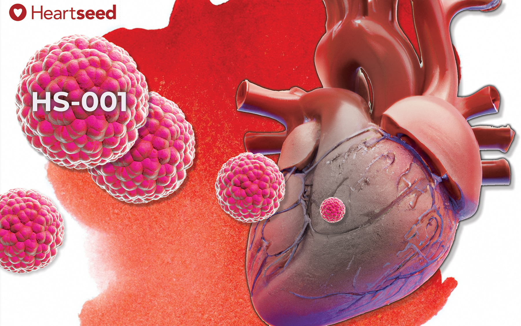 PRESS RELEASE: Successfully Seeding a Broken Heart – Heartseed Inc. succeeds in first human ...